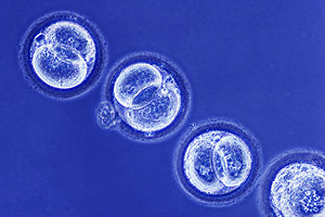 Religious Groups’ Official Positions on Stem Cell Research | Pew ...